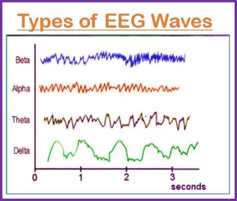 Types Of Eeg Monitoring At Sally Hyland Blog