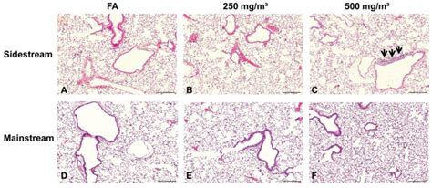 Chronic Obstructive Pulmonary Disease Copd Models Creative Bioarray