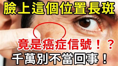 臉上這個位置長斑，竟是癌症信號！？醫生嚴厲提醒：千萬別不當回事【中老年之家】 Youtube