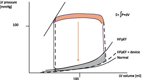 Pressure Volume Pv Loop Schematic Pv Loops And Representation Of 3 Download Scientific
