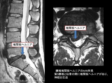 部屋とヘヴィメタルと私 楽天ブログ
