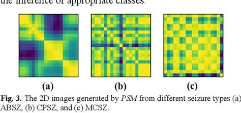 Figure 1 From Seizure Type Detection Using Eeg Signals Based On Phase Synchronization And Deep