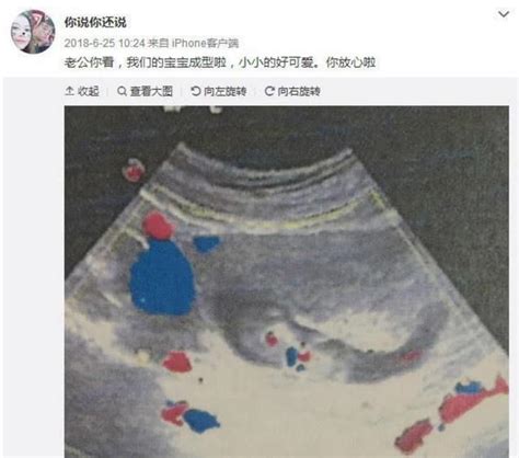 張馨予將畫送給了一位老公光榮犧牲的警嫂，發文安慰：願一切安好 每日頭條