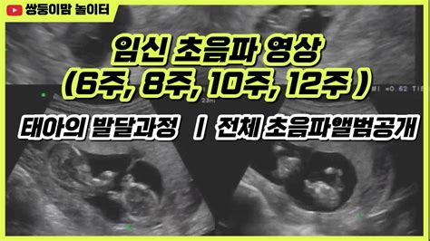 임신브이로그ㅣ 6주 8주 10주 12주 초음파 영상ㅣ쌍둥이임산부ㅣ태아발달과정 ㅣ태아초음파앨범 전체공개 Youtube