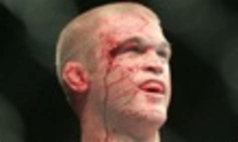 Evan Dunham Vs Paul Sass Added To Ufc On Fox 2 Ufc