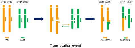 Acute Promyelocytic Leukemia Apl Cancer Genetics And Genomics