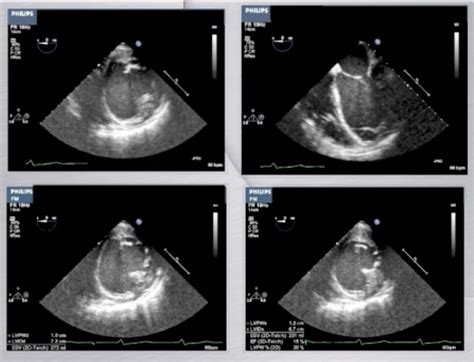 Comprehensive Assessment Of Lv Function Module 4 Openanesthesia