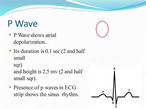 Intraoperative Monitoring Pptx