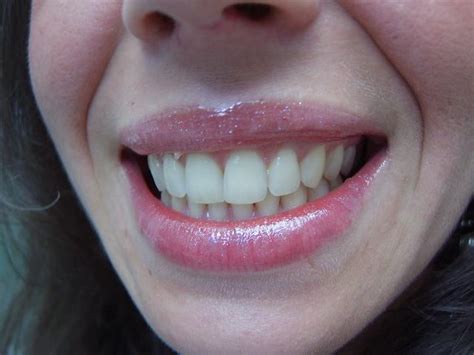 Stomatološka Ordinacija Dr Milan Pavlović Beograd