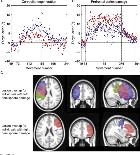 Figure 6 From Cerebellar And Prefrontal Cortex Contributions To Adaptation Strategies And