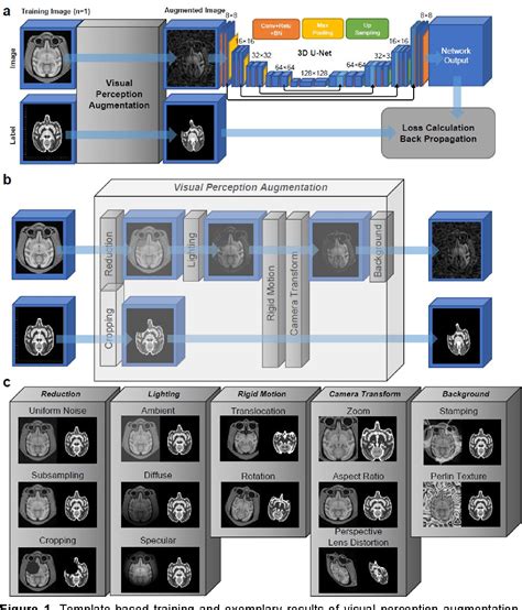 Figure 1 From Brain MRI Segmentation Using Template Based Training And