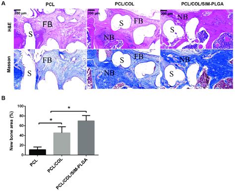 Analysis Of Bone Regeneration Of The Femur Defect By Using He And