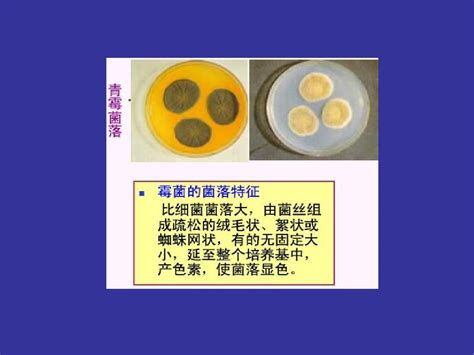 1真菌显微形态观察和微生物菌落形态比较 word文档在线阅读与下载 无忧文档