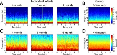 Age Dependent Electroencephalogram Eeg Patterns During Sevoflurane