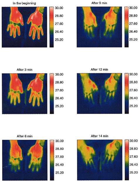An Example Of Thermographic Data Obtained Under Graded Load Download Scientific Diagram