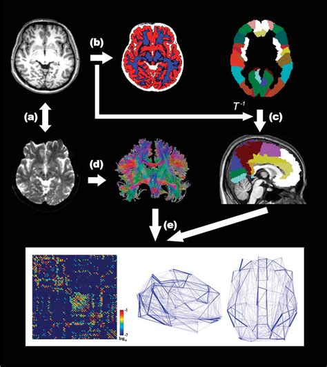 Figure 1 From Sex And Brain Size Related Small World Structural Cortical Networks In Young