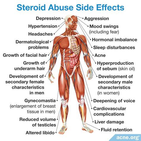Steroids Side Effects Acne