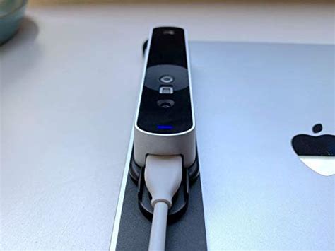 Structure Sensor 3d Scanner For Orthopaedics