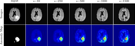 Figure 5 From Diffusion Models For Medical Anomaly Detection Semantic Scholar