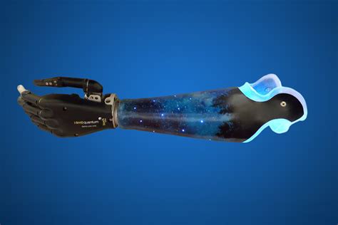 Upper Limb Prostheses Whats Your Style