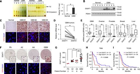 Targeting Dgat1 Ameliorates Glioblastoma By Increasing Fat Catabolism