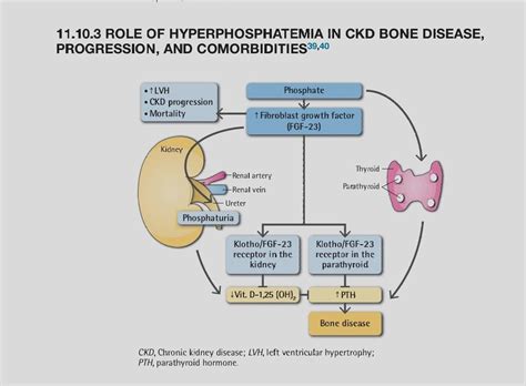 Basem Askar On Linkedin Hyperphosphatemia And Ckd