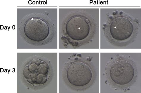 The Morphology Of A Control Zygote And The Affected Individuals