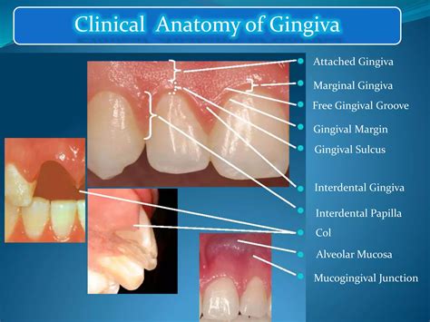 Macroscopic Features Of Gingiva Pptx