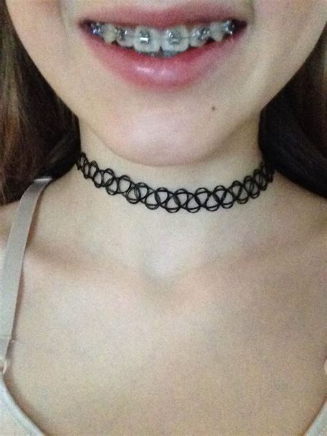 Pin Von Paige Auf Braces