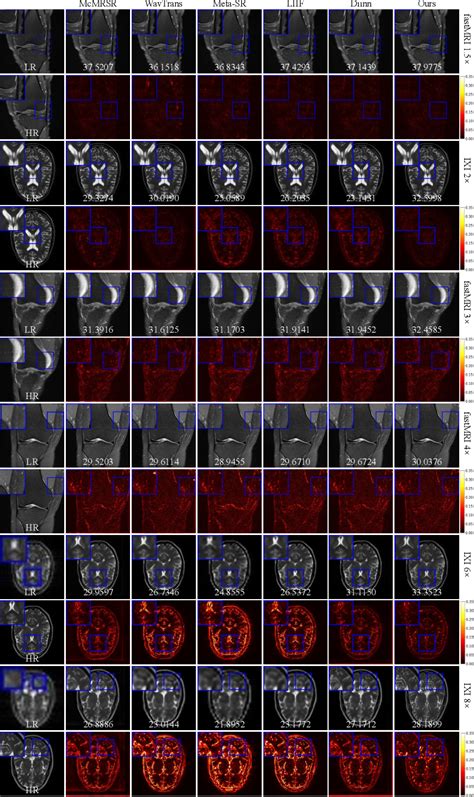 figure 3 from dual arbitrary scale super resolution for multi contrast