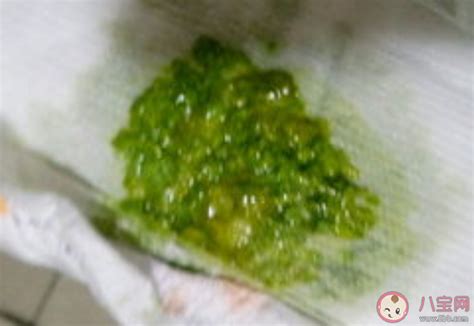 宝宝拉绿色大便是怎么回事 哪些异常大便要送医 八宝网