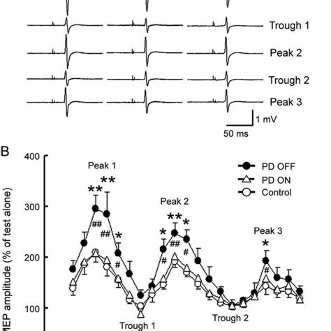 Short Interval Intracortical Inhibition And Intracortical Facilitation