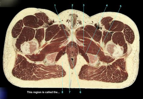 Net Anatomy Cross Sectional Male Pelvis 7 Diagram Quizlet