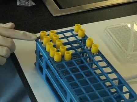 Video Measuring The 50 Haemolytic Complement CH50 Activity Of Serum