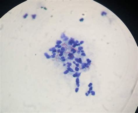Z N Staining Method Afb Stain Part 2