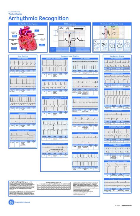 The 25 Best Ekg Interpretation Ideas On Pinterest Acls Medications