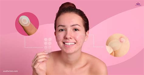 How Do Pimple Patches Work Are They Making Acne Worse