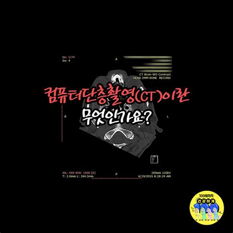 컴퓨터단층촬영 Ct이란 무엇인가요