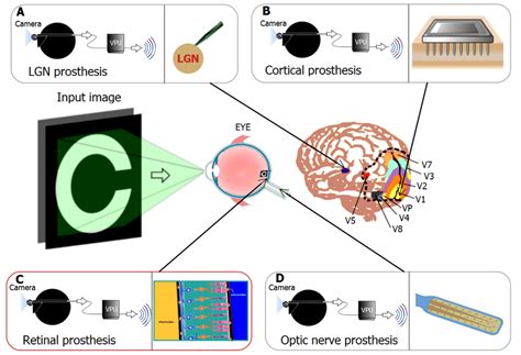 Main Approaches For The Design Of A Visual Prosthesis A Schematic Download Scientific Diagram