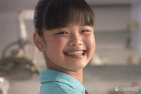 “最丑童星”王莎莎：曾遭北影拒绝，出演“莫小贝”后再无突破？演技网友长相