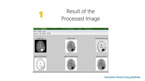 Brain Tumor Detection Using Image Processing Pptx