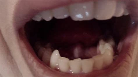 Dentist Likes My Sharp Teeth Fatalitas Ilusione Clips4sale