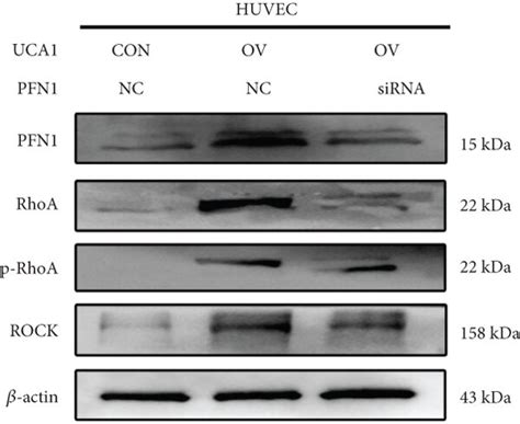 Exosomal Uca1 Promotes Endothelial Injury In Huvecs By Inducing Ros