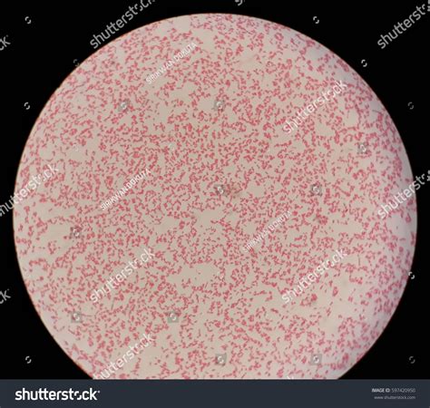 Gram Negative Bacilli 100x Gram Negative Bacilli 100x