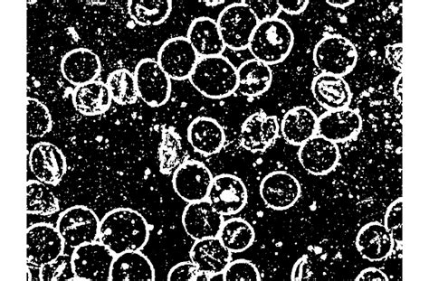 image segmenting rings i e non full objects in r in ebiimage or