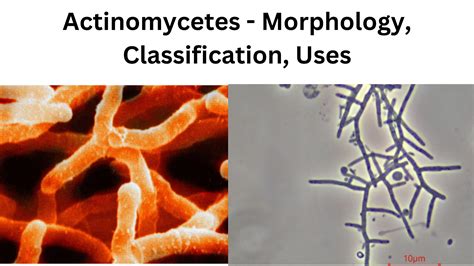 Bacteriology Microbiology Note