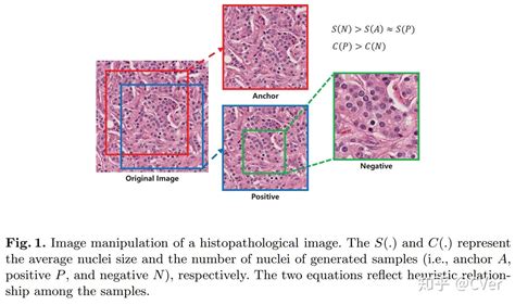 Miccai 2020 用于细胞核分割的实例感知的自监督学习 知乎