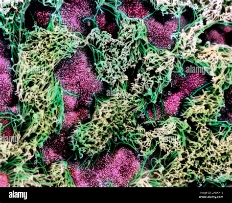 Fallopian Tube False Colour Scanning Electron Micrograph Of The