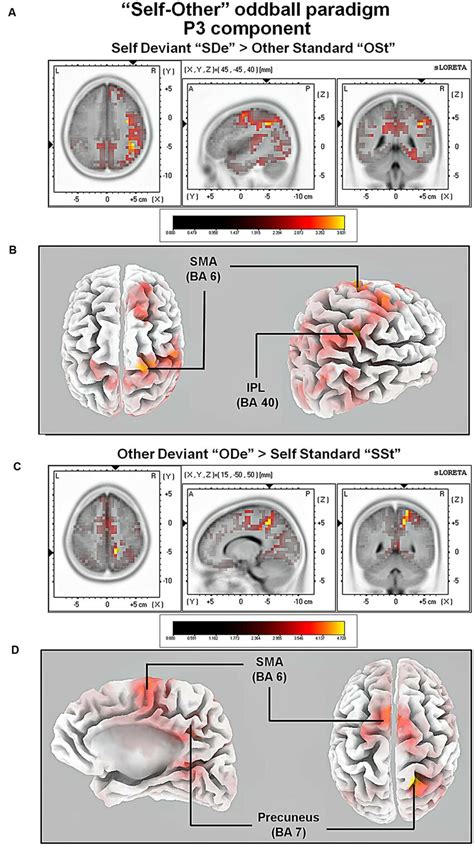 Results Of The Sloreta Source Localization Analysis Contrasts Sde