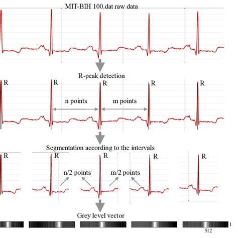 Data Preprocessing Pipeline Using Heartbeats In The Mitdb Record 100 Download Scientific Diagram
